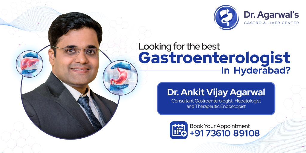 Best Gastroenterologist in Hyderabad | Dr. Ankit Vijay Agarwal